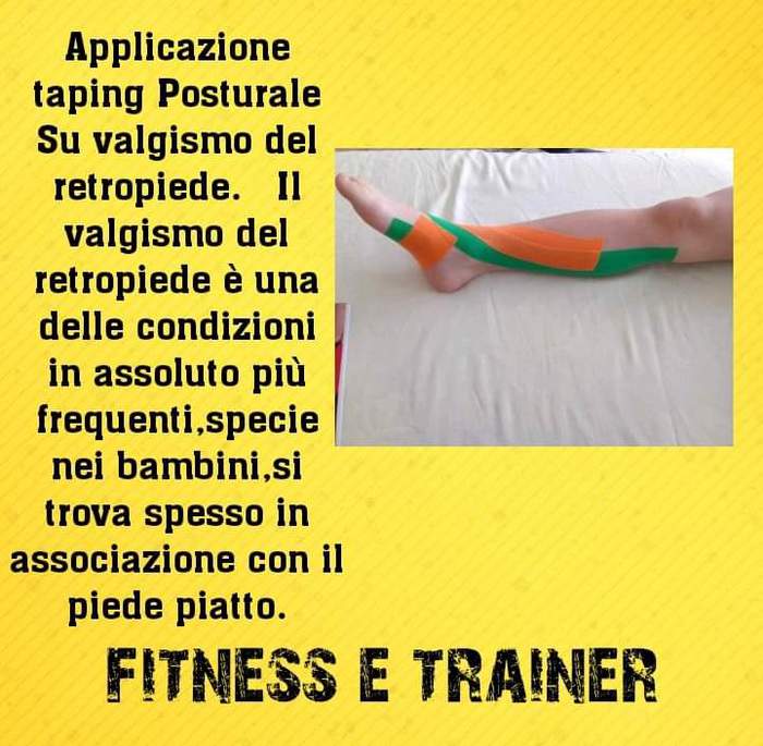 Galleria immagini Taping neuromuscolare :: Fitnessetrainer